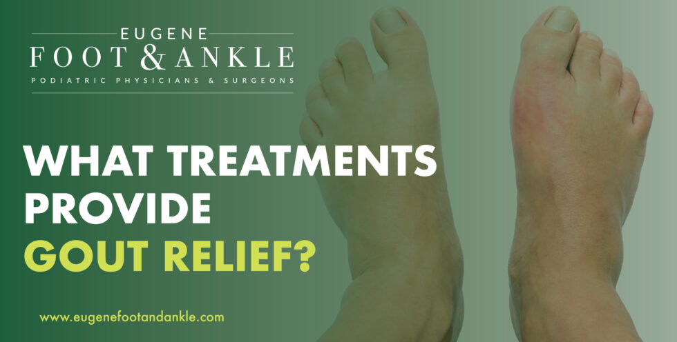 Gout Relief Treatments | Eugene Foot & Ankle