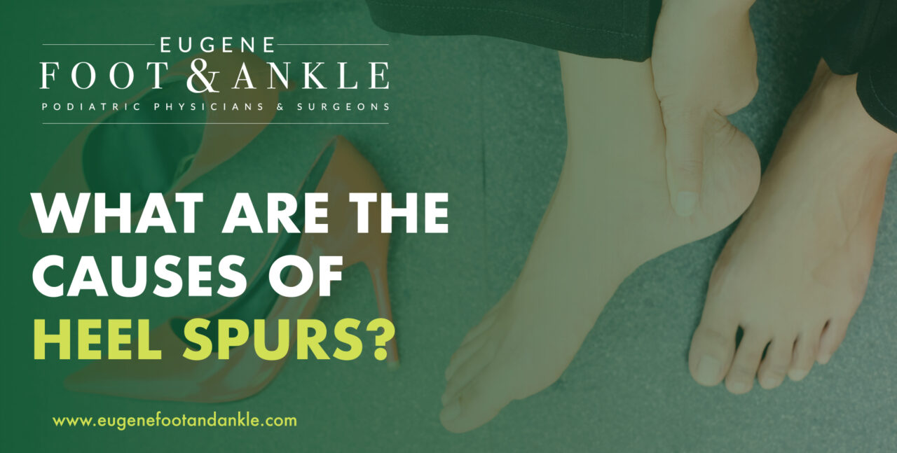 Heel Spurs Don't Usually Cause Heel Pain | Eugene Foot & Ankle