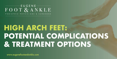 High Arch Feet | Treatment Options | Eugene Foot & Ankle