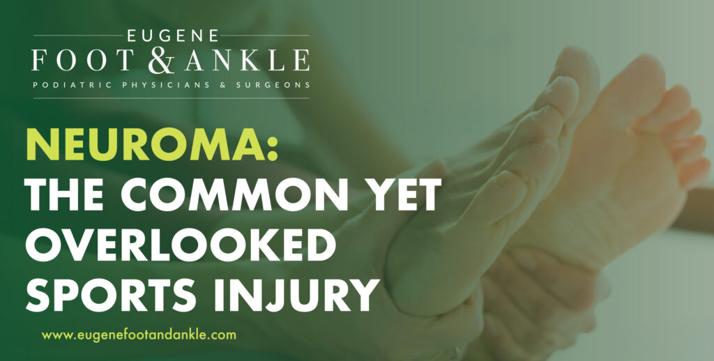 Neuroma | An Overlooked Injury | Eugene Foot & Ankle