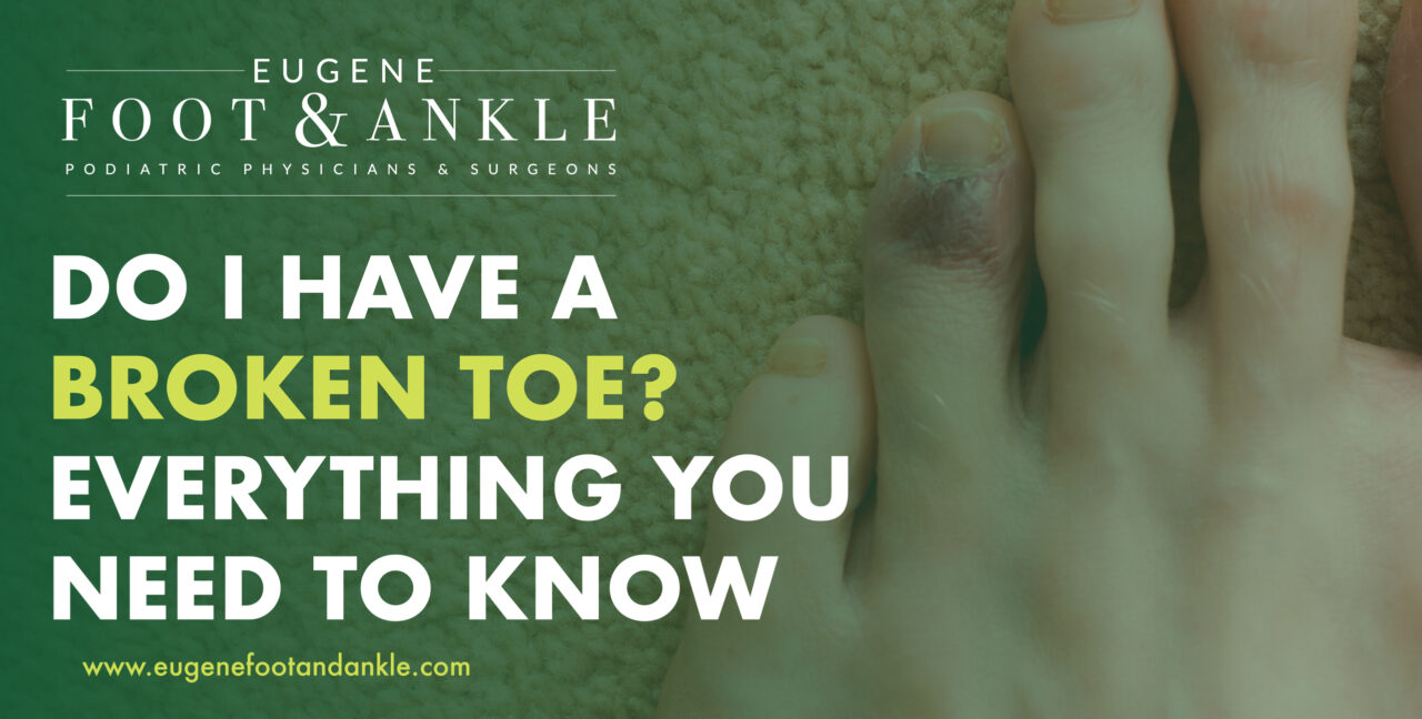 Broken Toe? | What to Know | Eugene Foot & Ankle