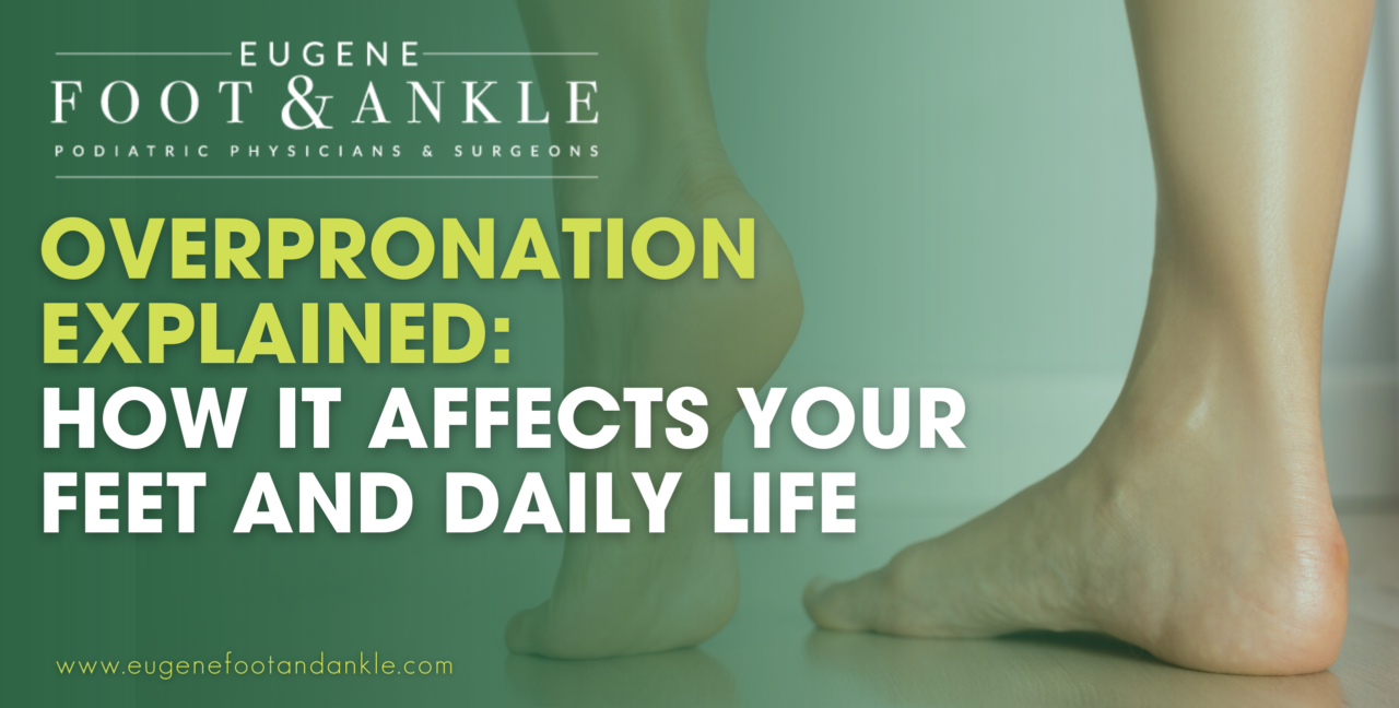 Overpronation Explained | Eugene Foot and Ankle