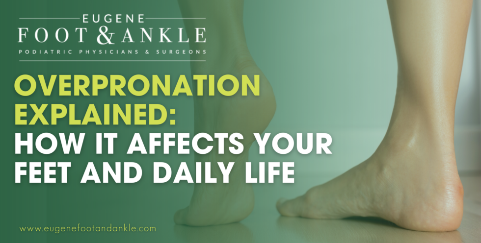Overpronation Explained | Eugene Foot and Ankle