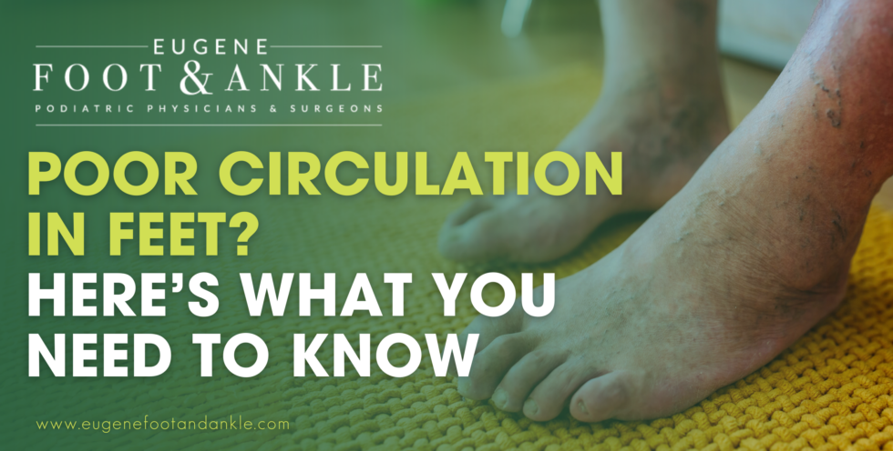 Poor Circulation in Feet? What to Know | Eugene Foot & Ankle